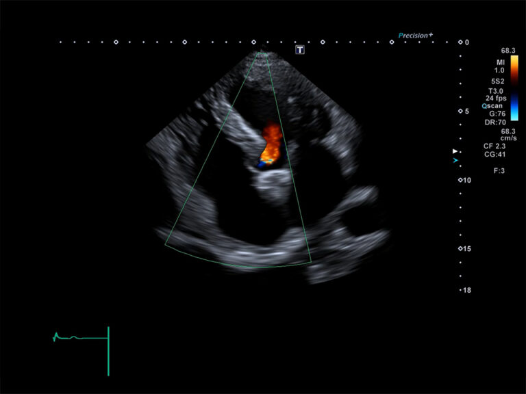 Aparat USG Canon Aplio A, nowoczesny ultrasonograf - TMS Sp. z o.o.
